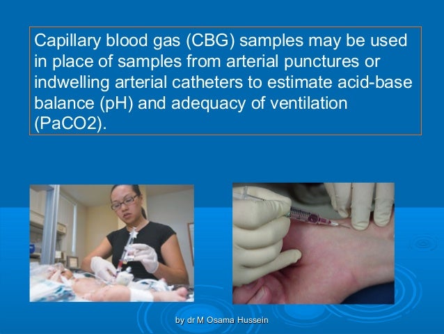 Interpretation of blood gases