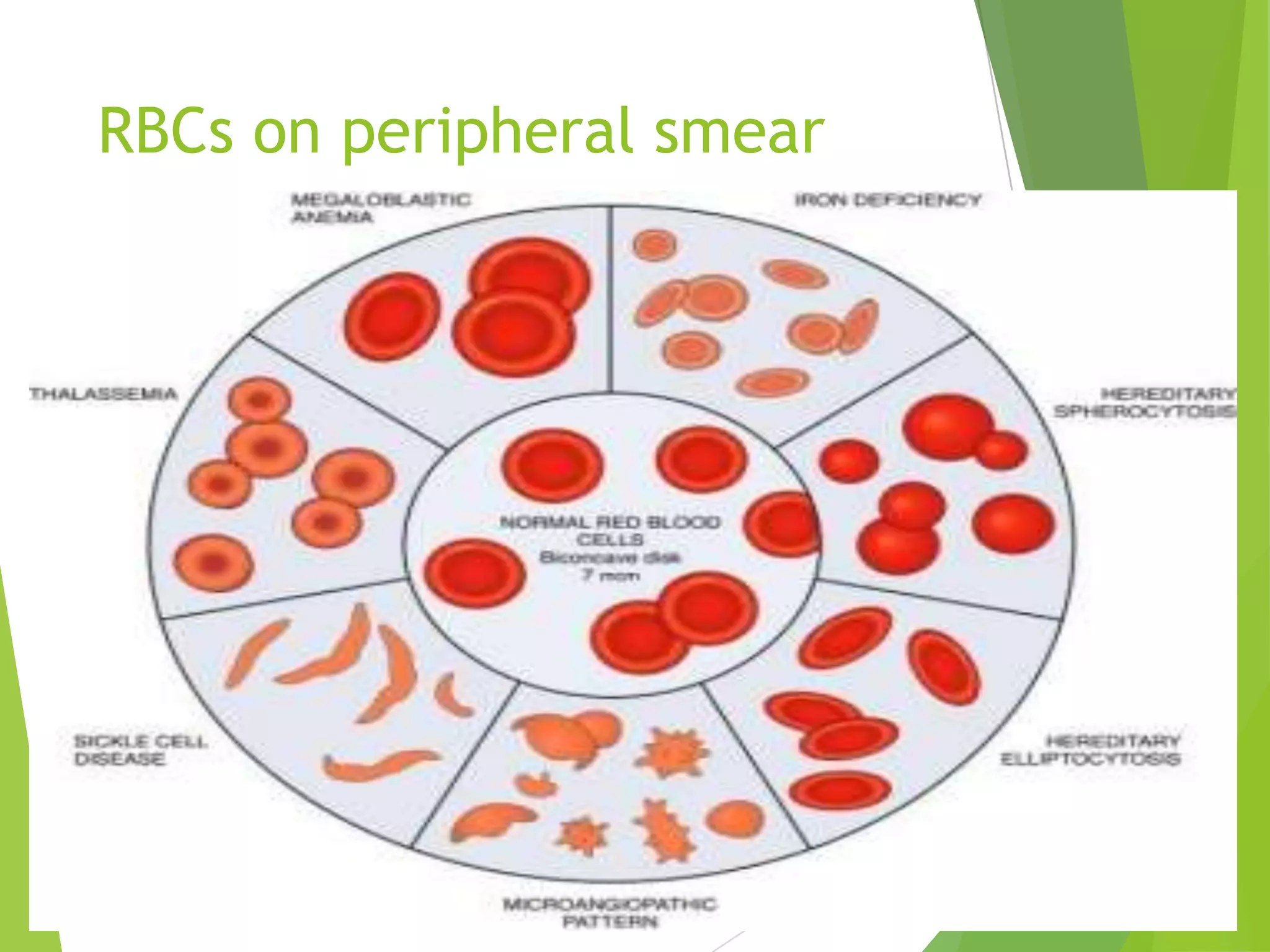 Interpretation of cbc | PPTX