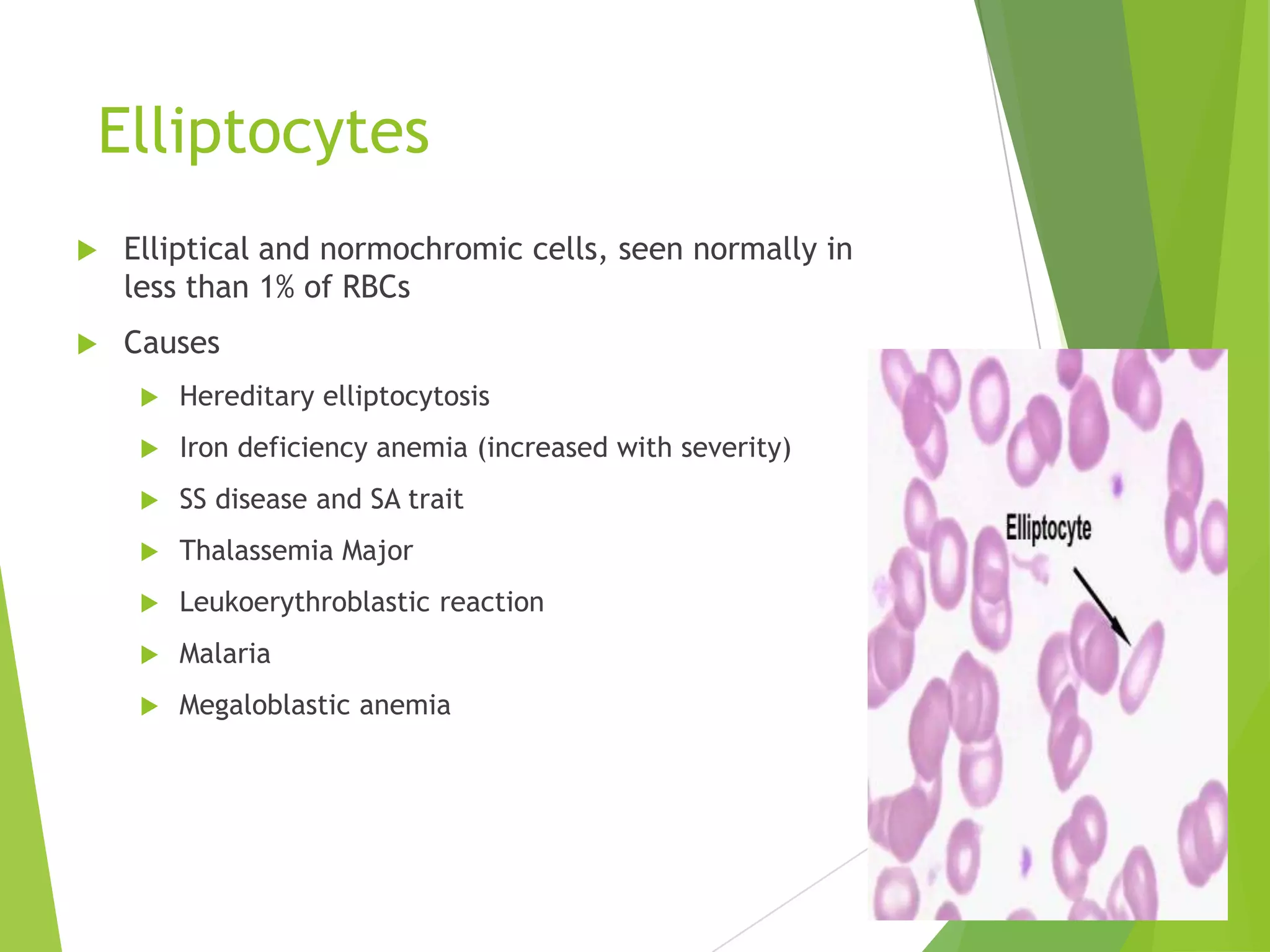 Interpretation of cbc | PPTX