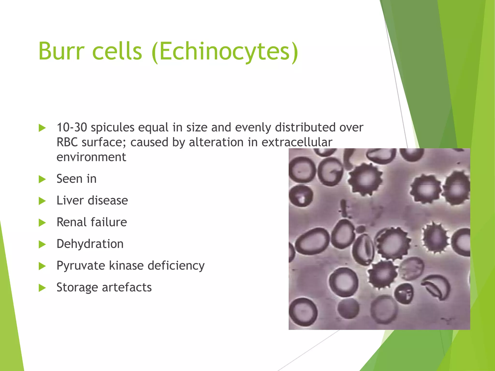 Interpretation of cbc | PPTX