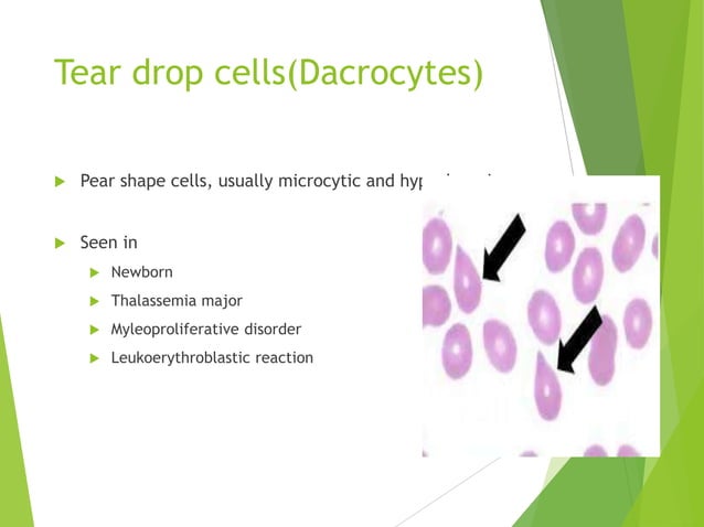 Interpretation of cbc | PPTX | Blood Disorders | Diseases and Conditions