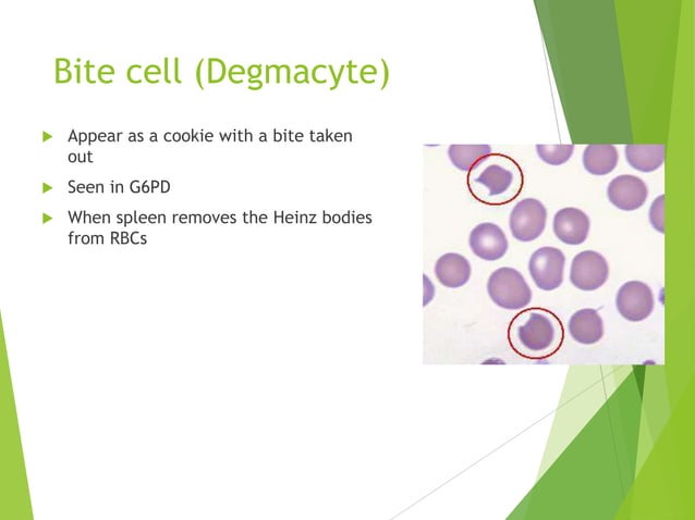 Interpretation of cbc | PPTX | Blood Disorders | Diseases and Conditions