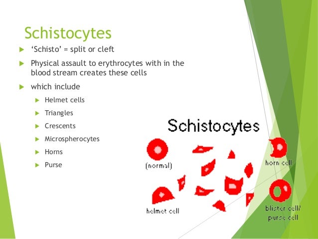 Interpretation of cbc