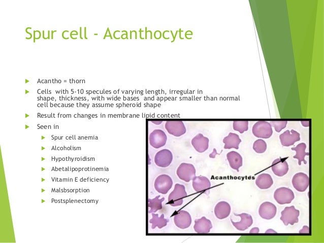 Interpretation of cbc