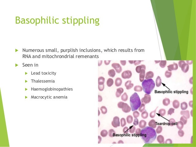 Interpretation of cbc