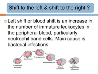 Interpretation of cbc | PPT