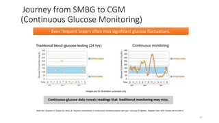 Interpretation of CGM .pptx