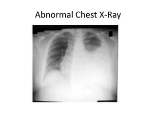 Interpretation Of Chest X Rays | PPTX