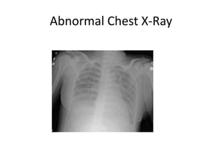 Interpretation Of Chest X Rays | PPTX