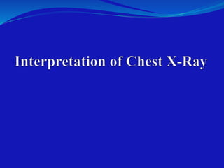 Interpretation of chest x ray | PPTX