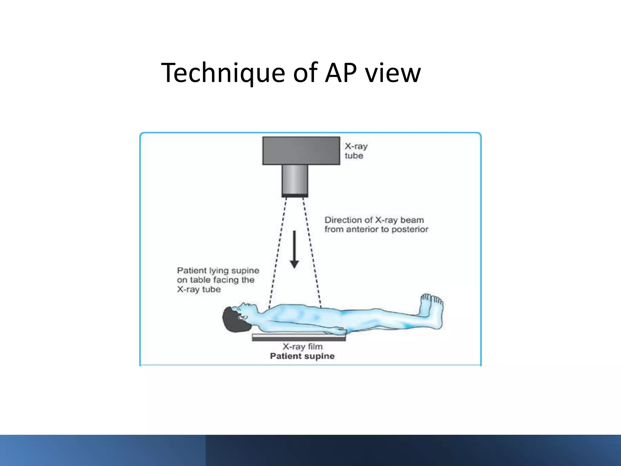 Interpretation of chest xray ppt | PPTX