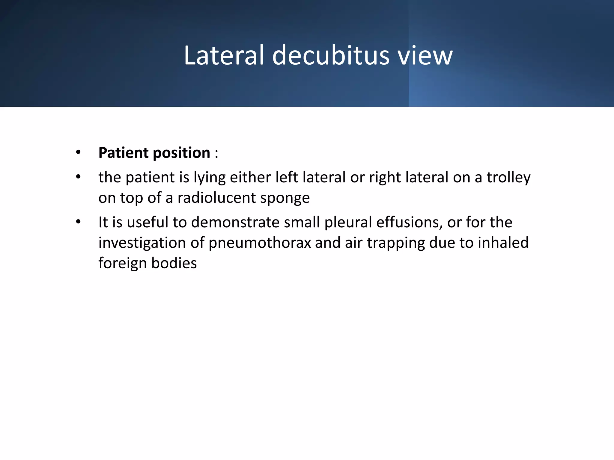 Interpretation of chest xray ppt | PPTX
