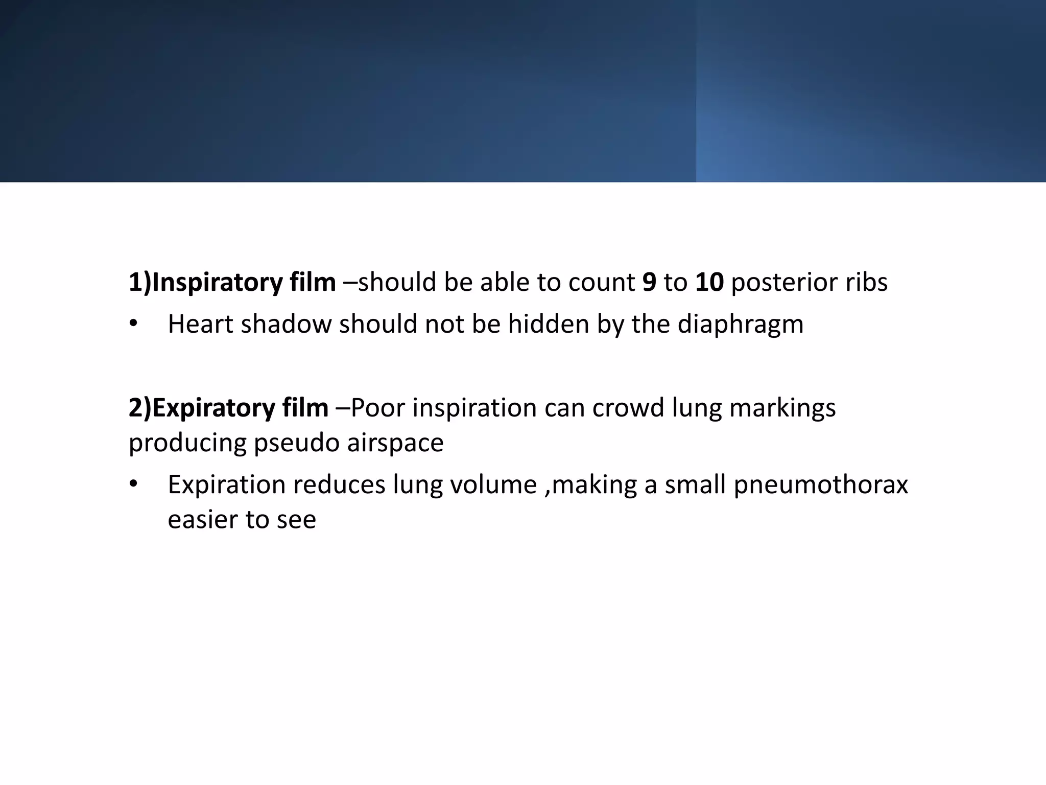 Interpretation of chest xray ppt | PPTX
