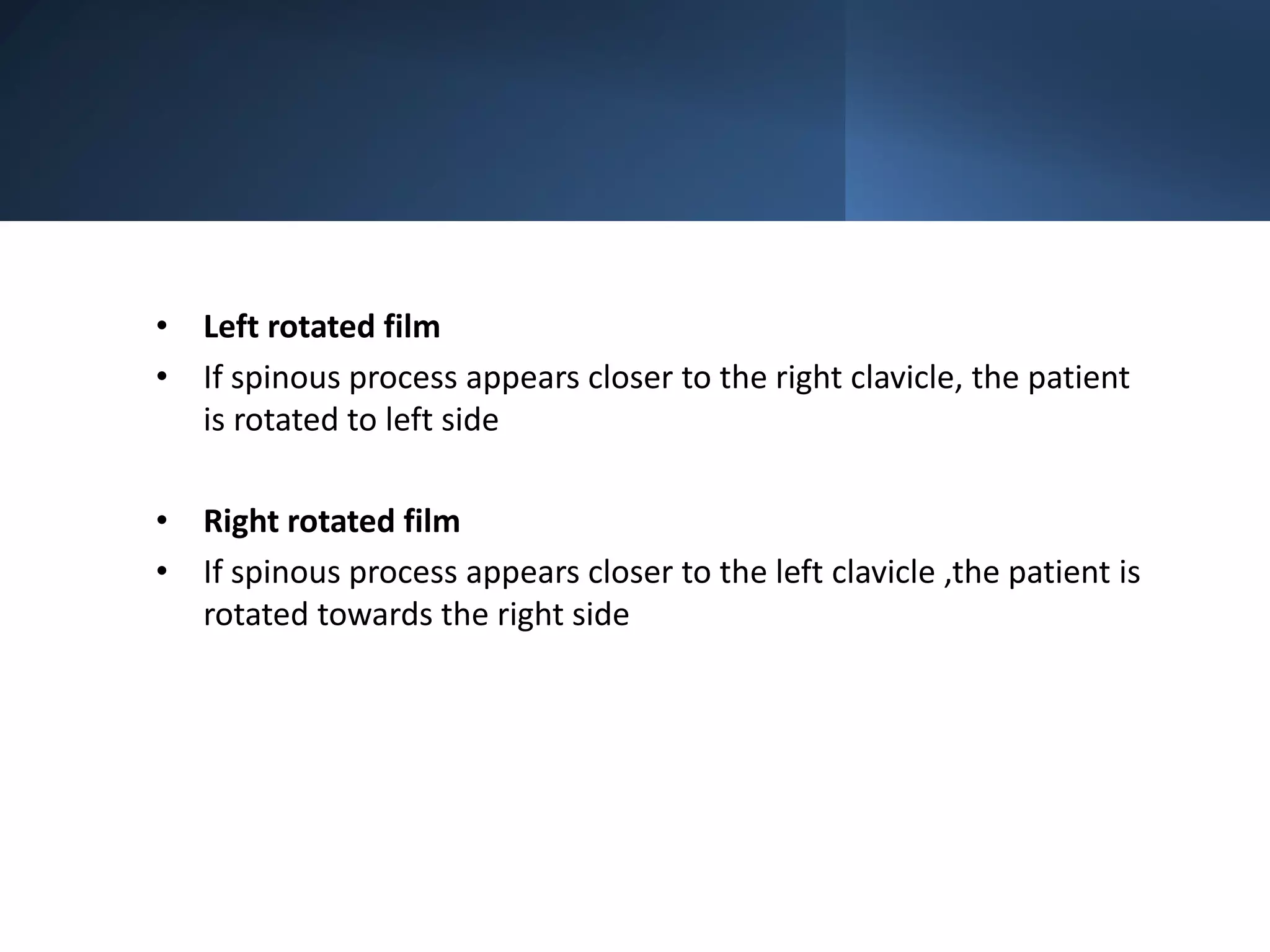 Interpretation of chest xray ppt | PPTX