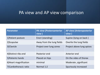 Interpretation of chest xray ppt | PPTX