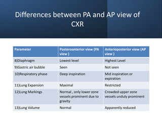 Interpretation of chest xray ppt | PPTX