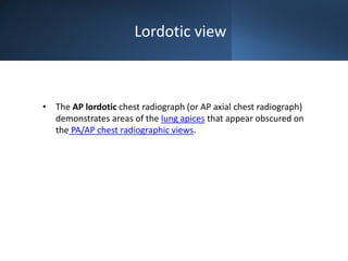 Interpretation of chest xray ppt | PPTX