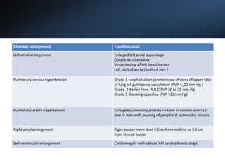 Interpretation of chest xray ppt | PPTX