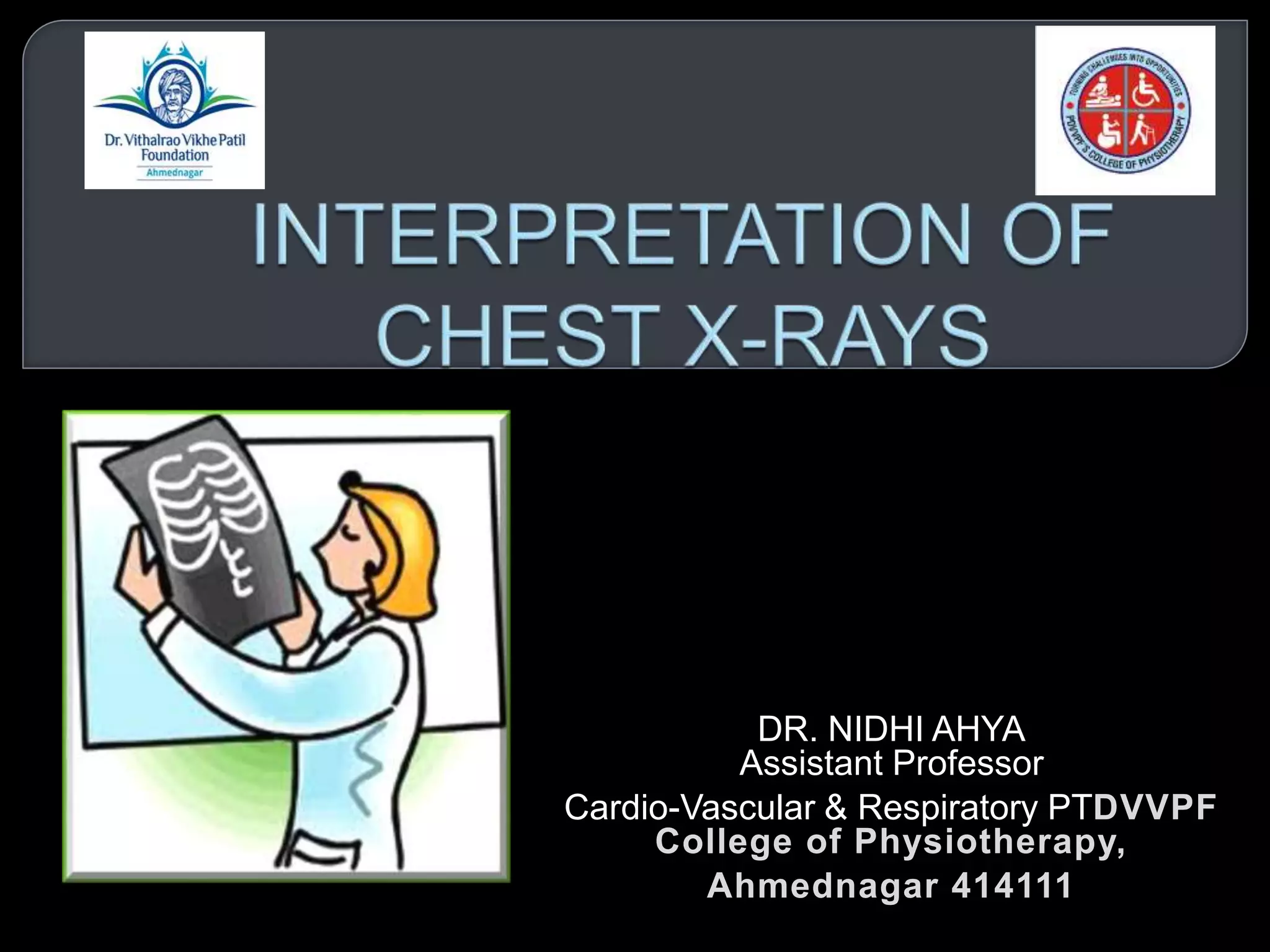 Interpretation of chest x-rays | PPTX