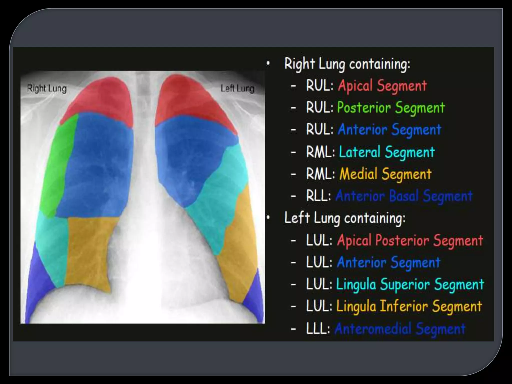 Interpretation of chest x-rays | PPTX
