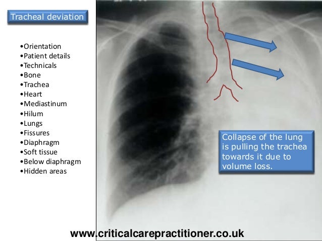 The structured interpretation of chest x rays.