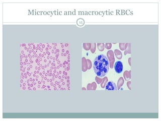 Interpretation of clinical laboratory test | PPTX