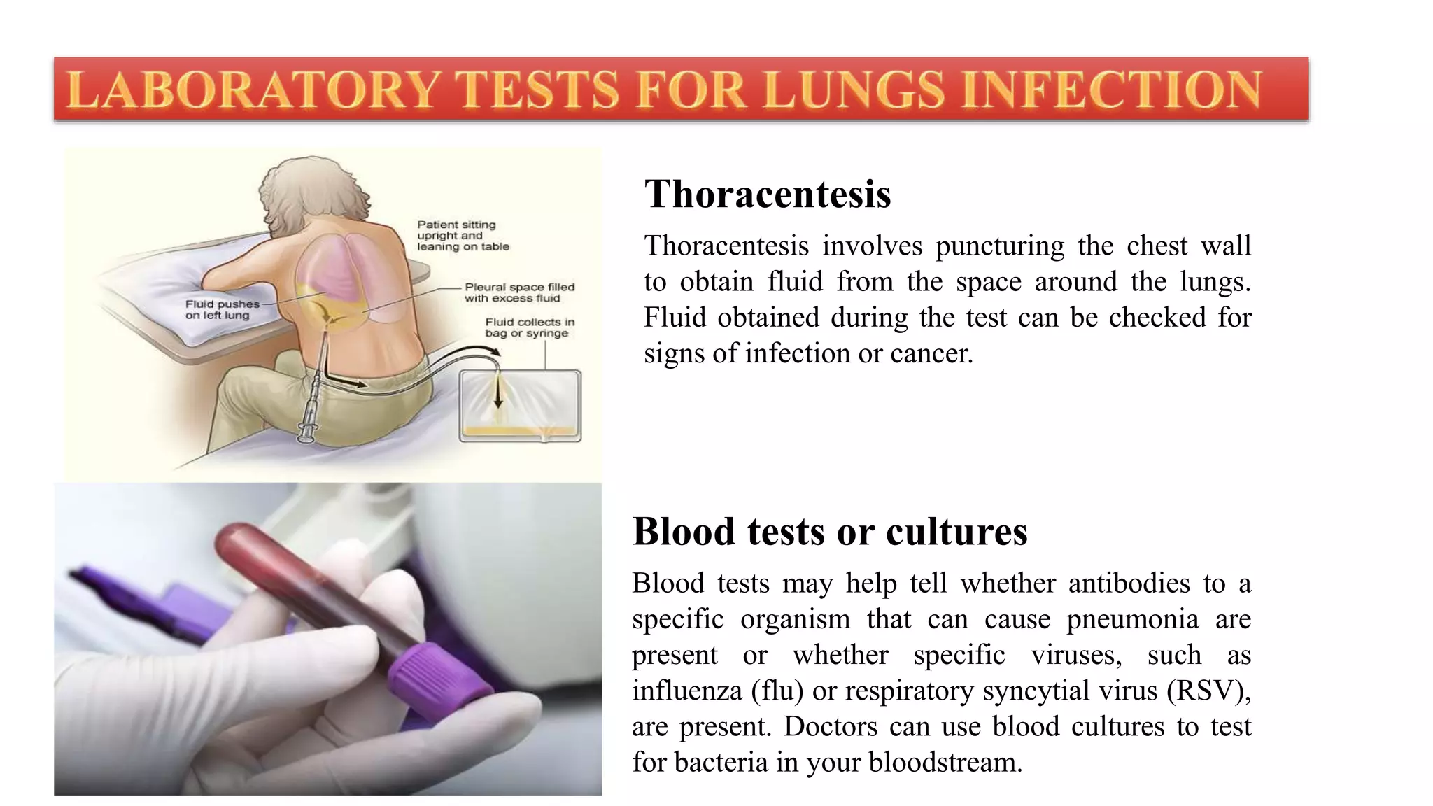 Interpretation of clinical laboratory test | PPTX