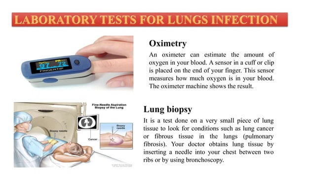 Interpretation of clinical laboratory test | PPTX | Blood Disorders ...