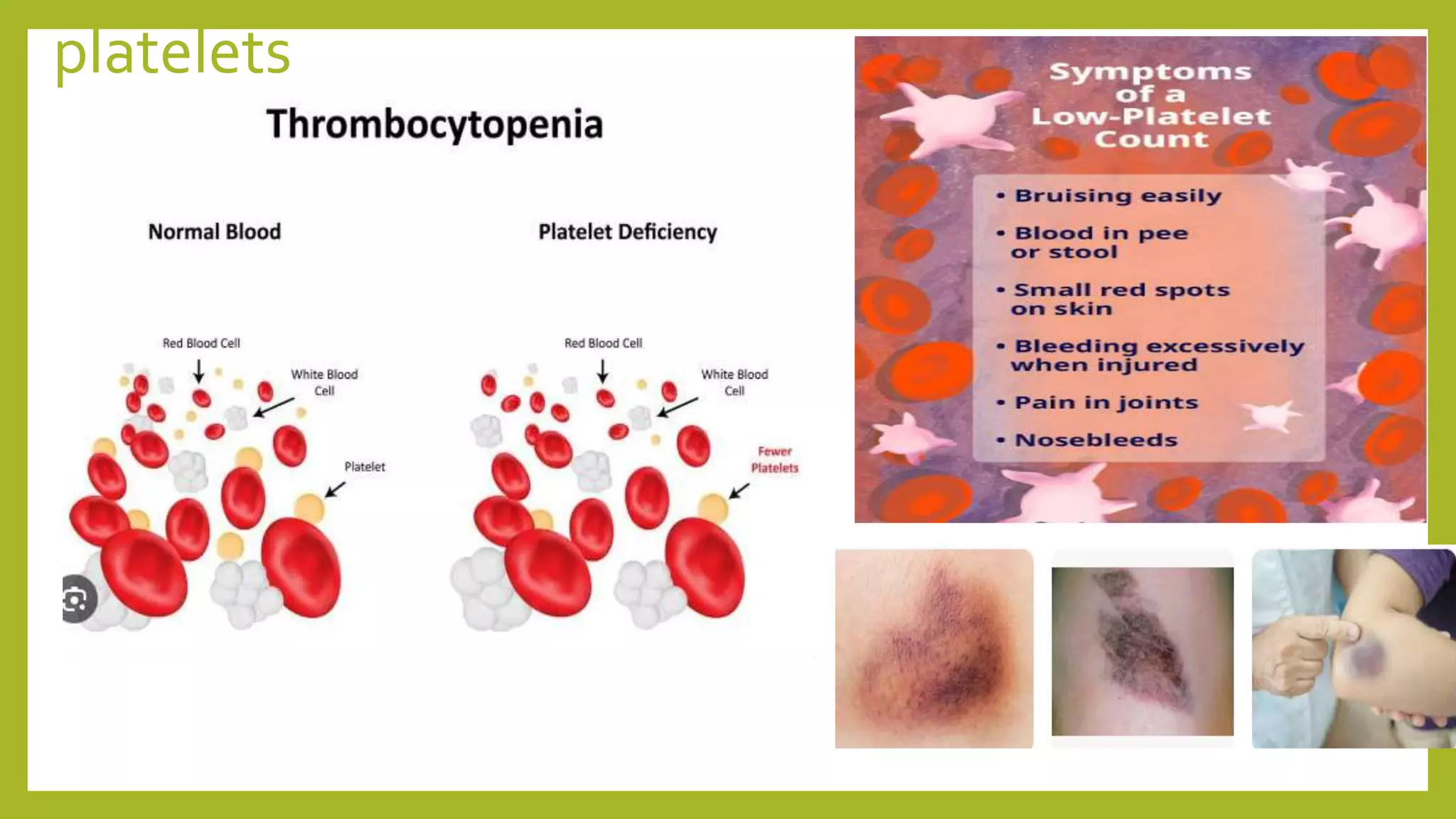 Interpretation of clinical laboratory test full.pptx