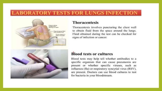 Interpretation of clinical laboratory test full.pptx