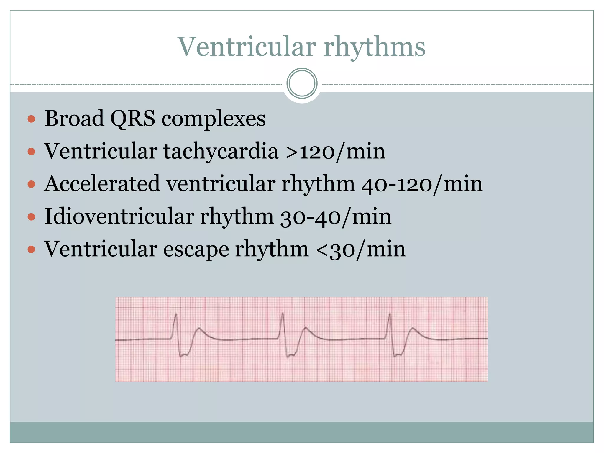 Interpretation of common ecg abnormalities | PPTX