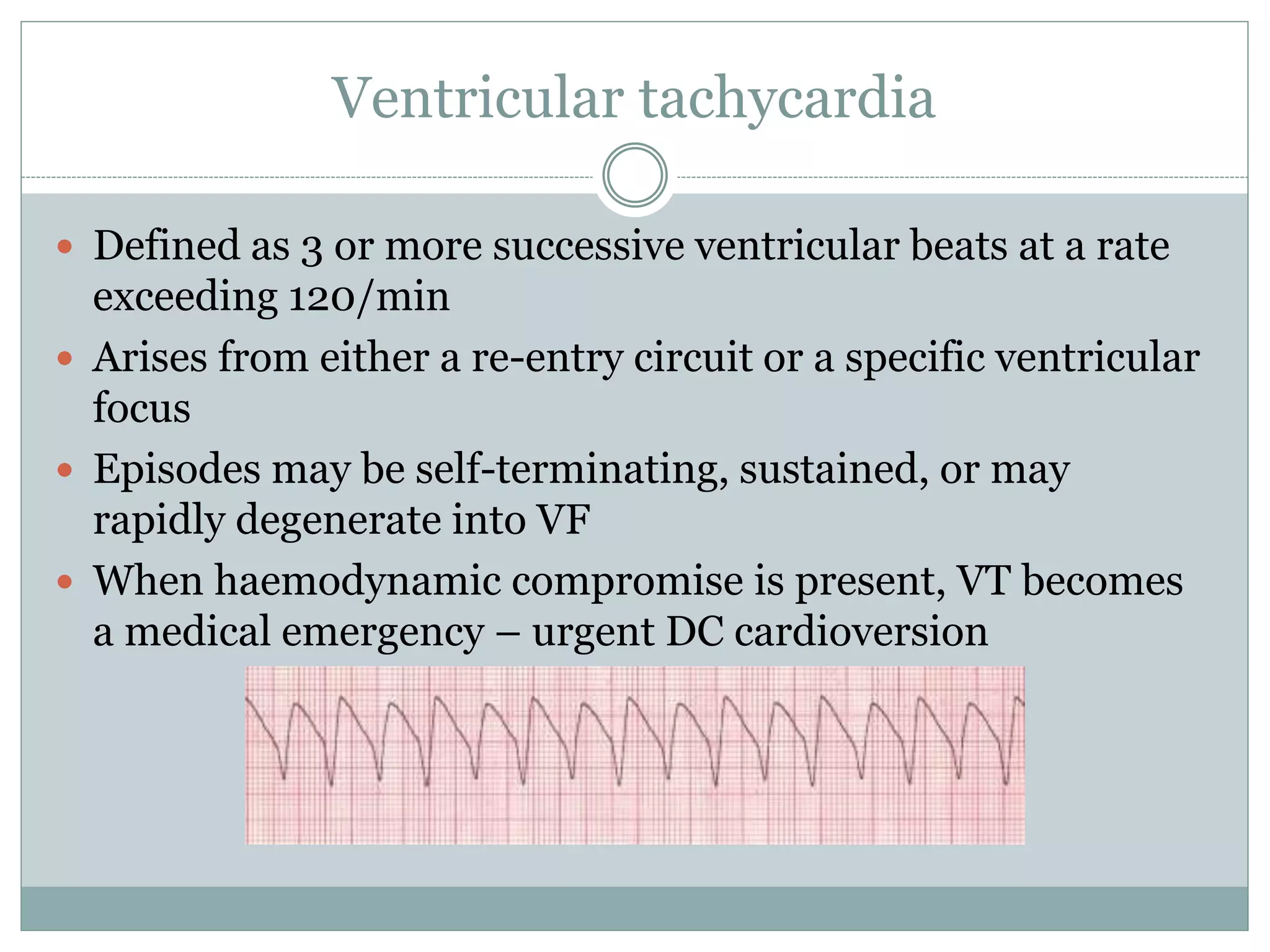 Interpretation of common ecg abnormalities | PPTX