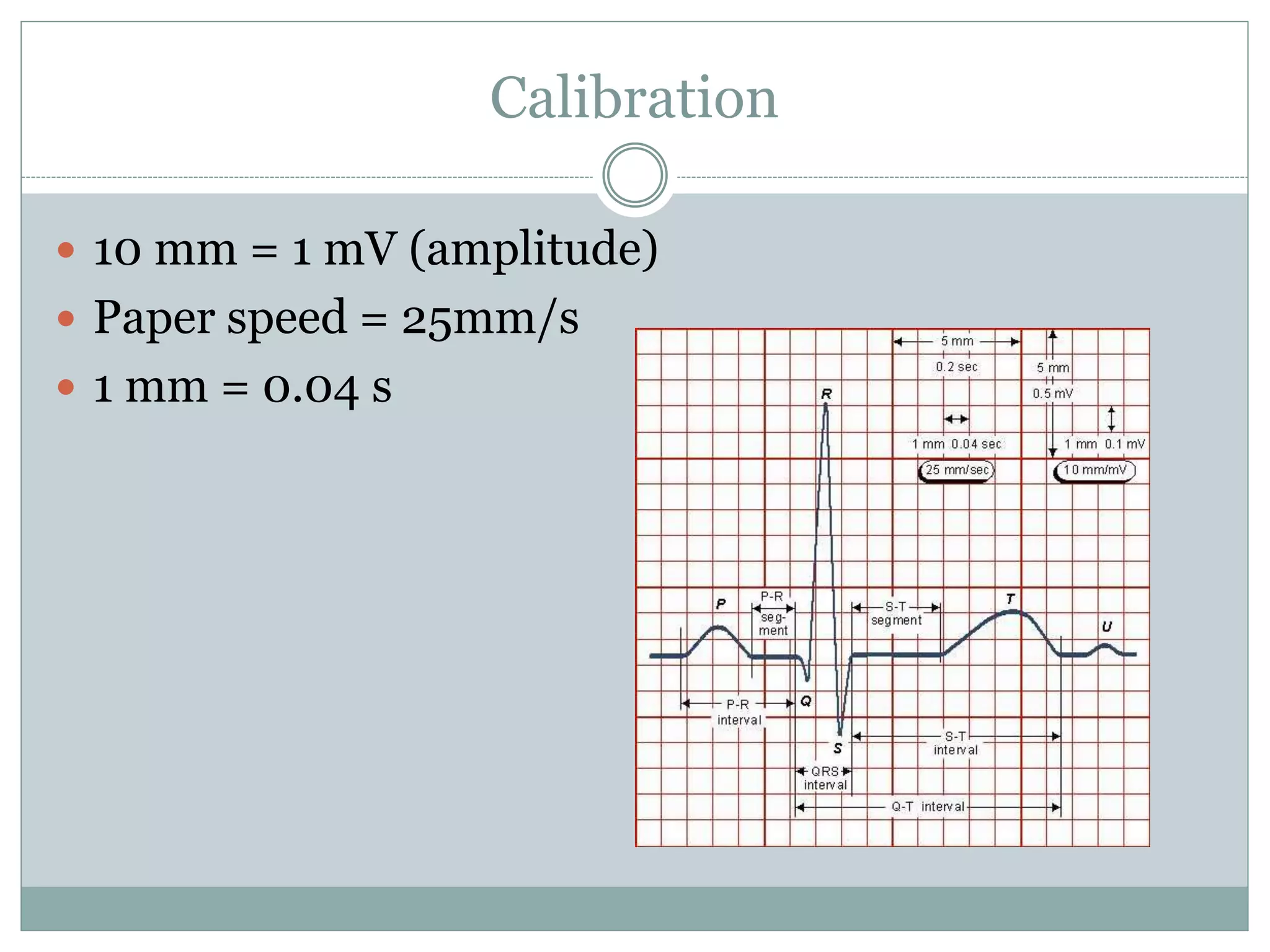 Interpretation of common ecg abnormalities | PPTX