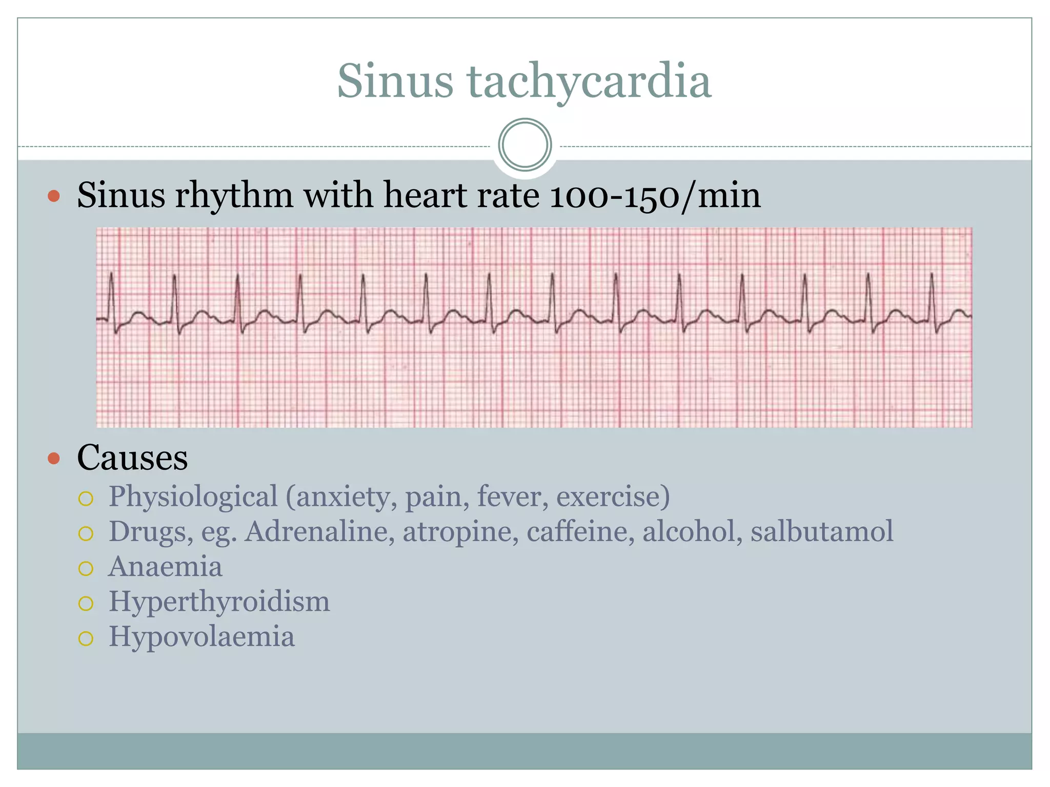 Interpretation of common ecg abnormalities | PPTX