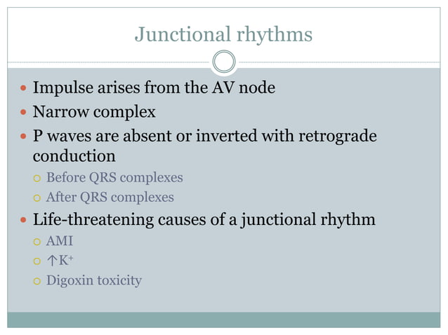Interpretation of common ecg abnormalities | PPTX