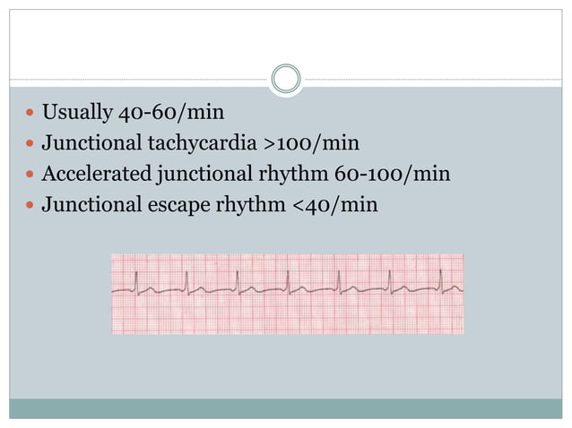 Interpretation of common ecg abnormalities | PPTX