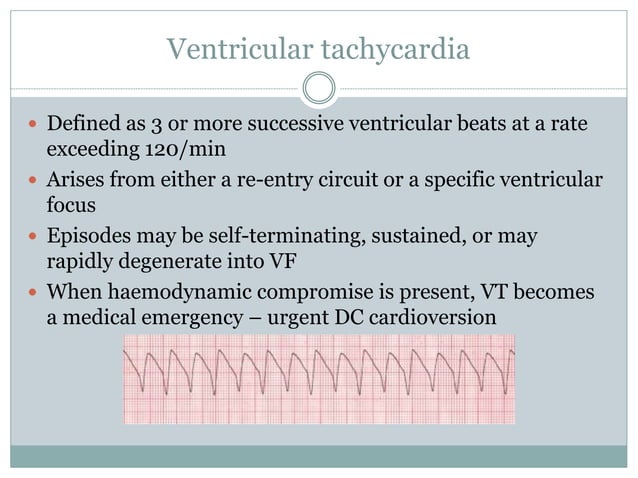 Interpretation of common ecg abnormalities | PPTX