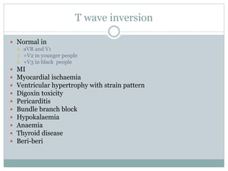 Interpretation of common ecg abnormalities | PPTX