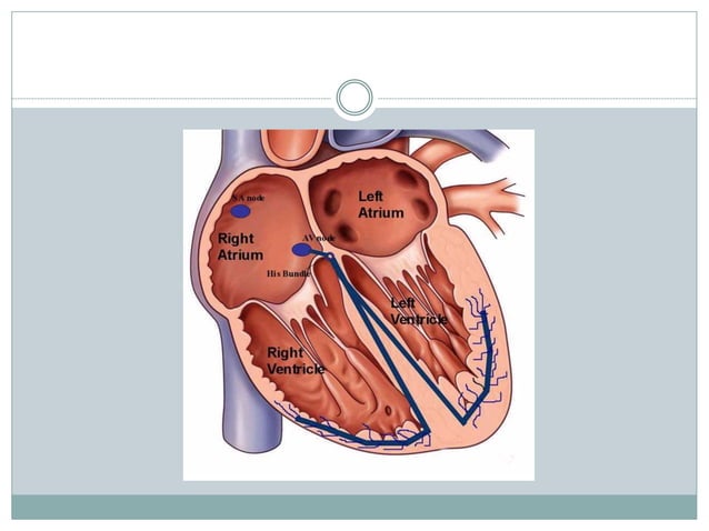 Interpretation of common ecg abnormalities | PPTX