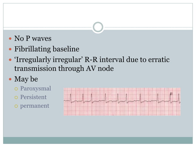 Interpretation of common ecg abnormalities