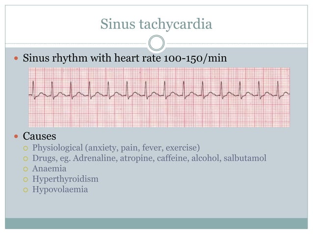 Interpretation of common ecg abnormalities