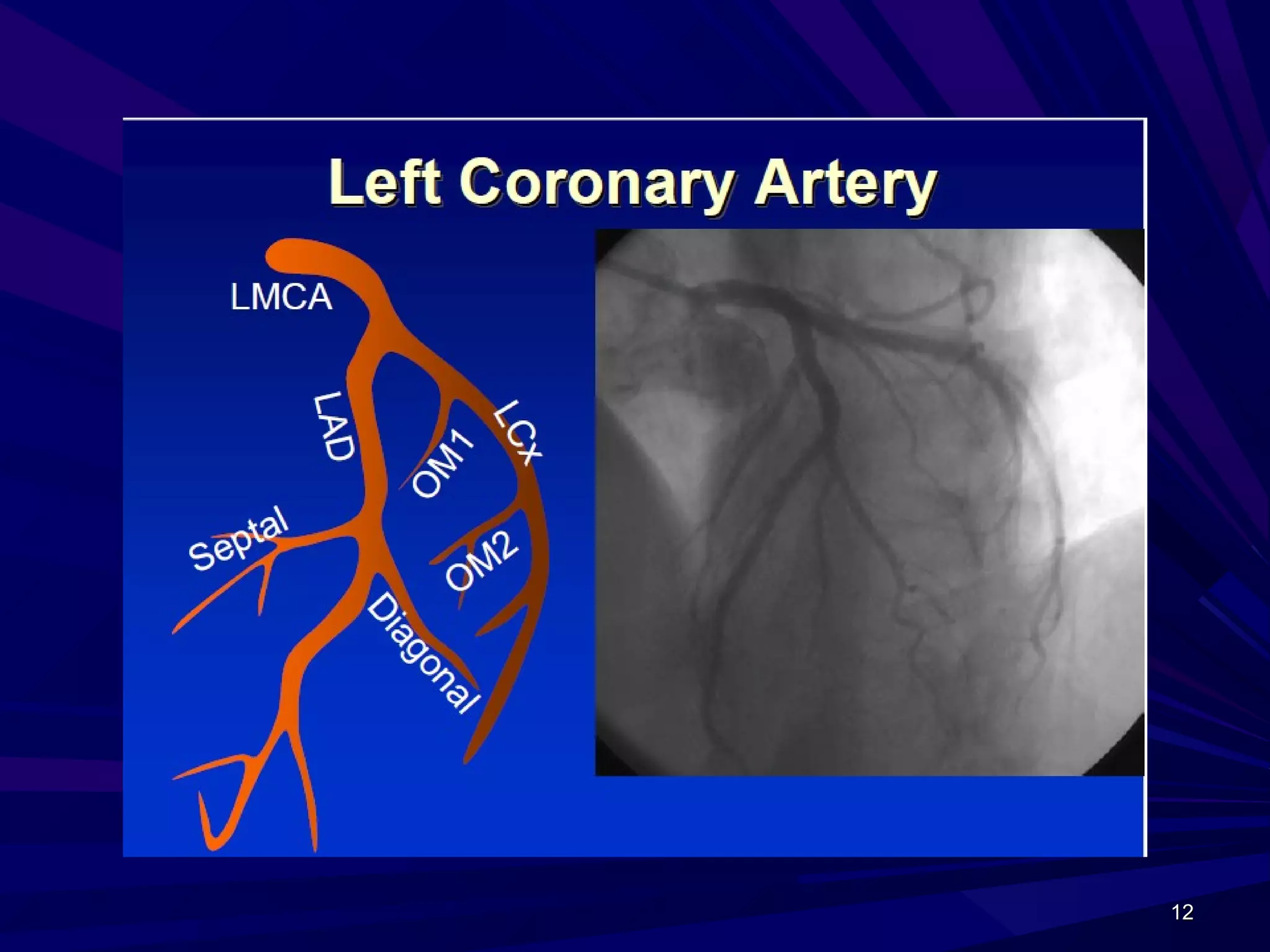Interpretation of coronary angiogram | PPT