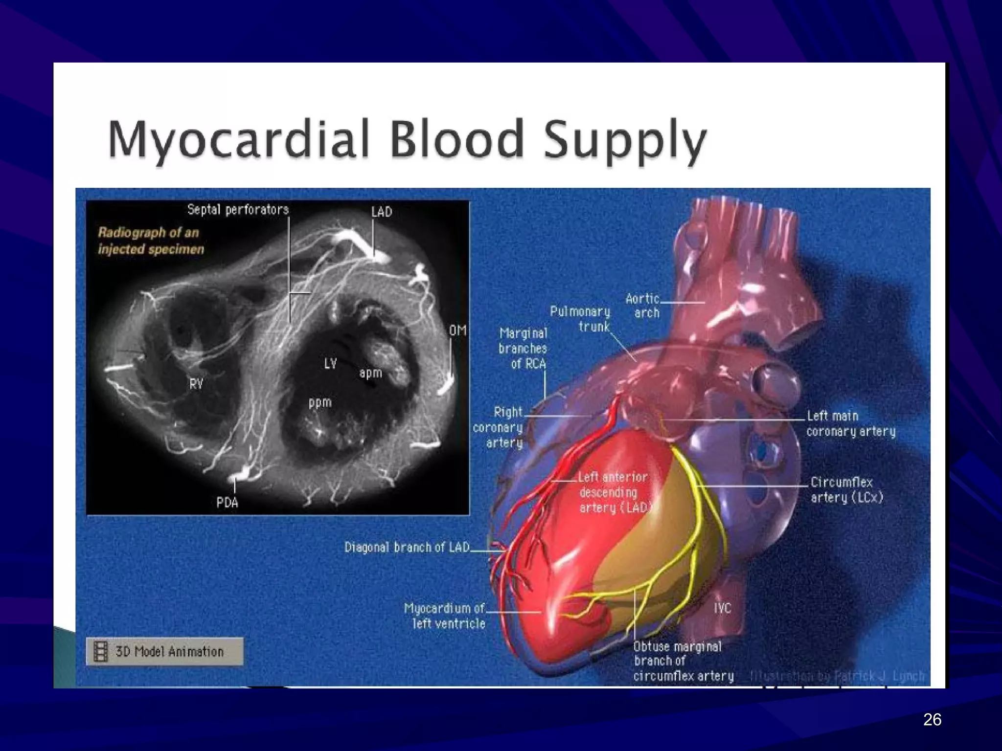 Interpretation of coronary angiogram | PPT