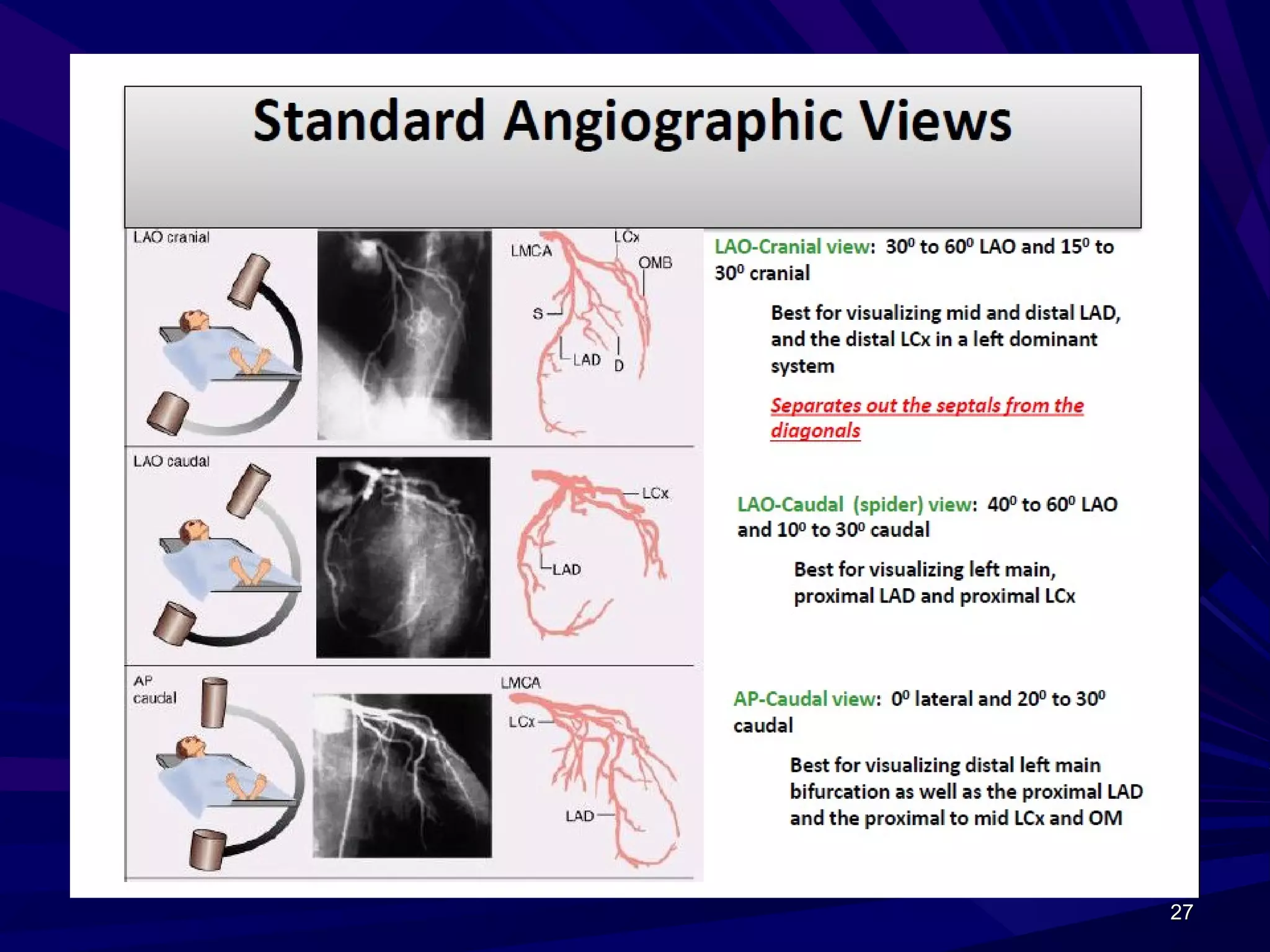 Interpretation of coronary angiogram | PPT