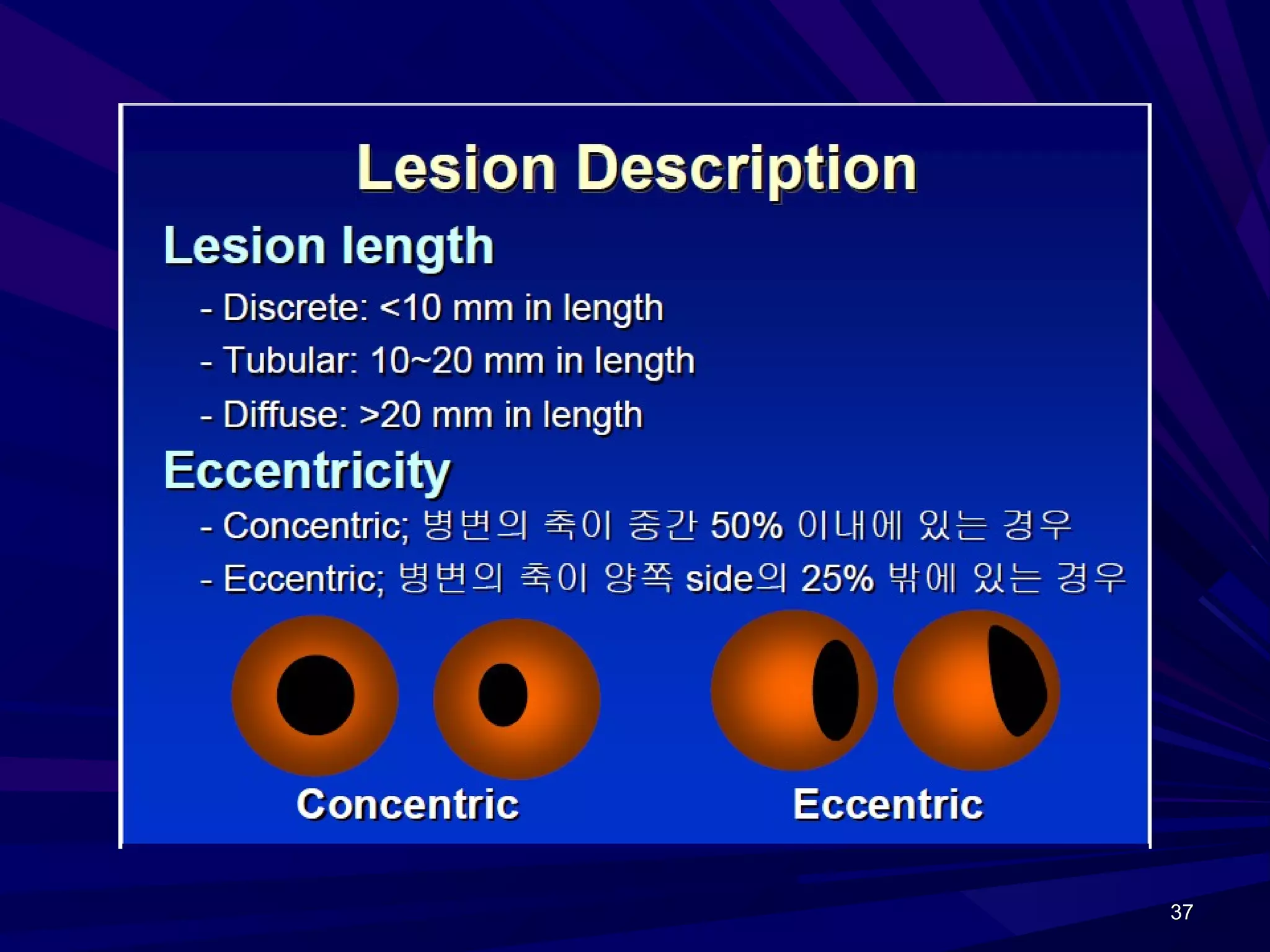 Interpretation of coronary angiogram | PPT