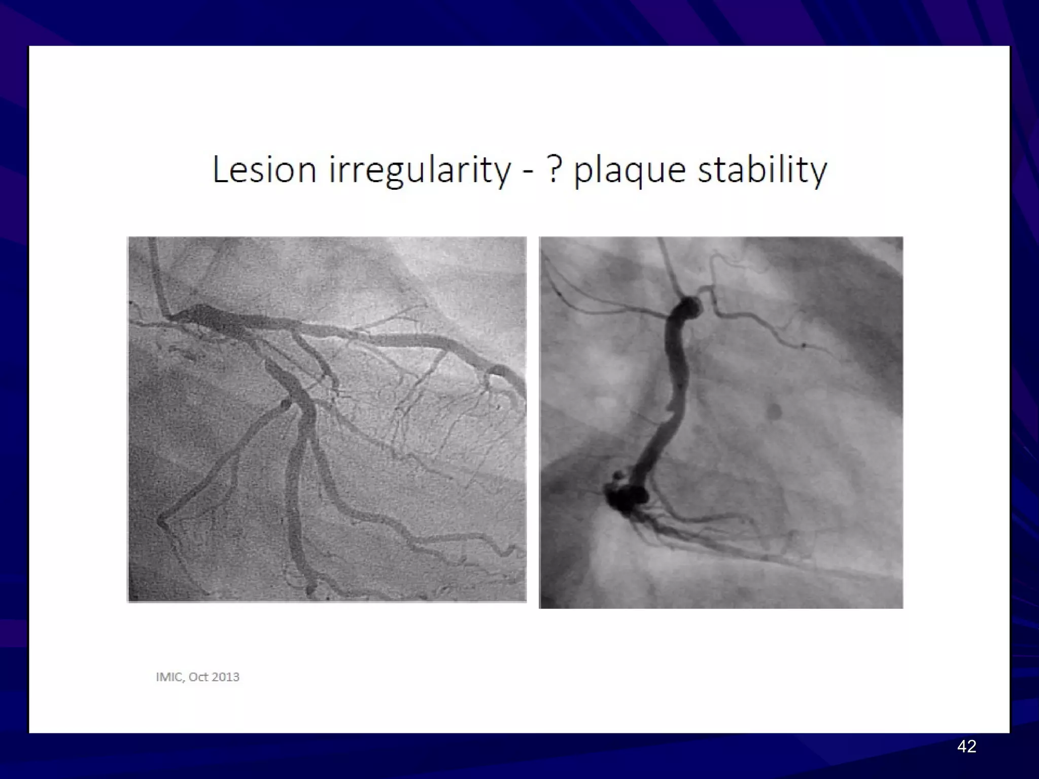 Interpretation of coronary angiogram | PPT