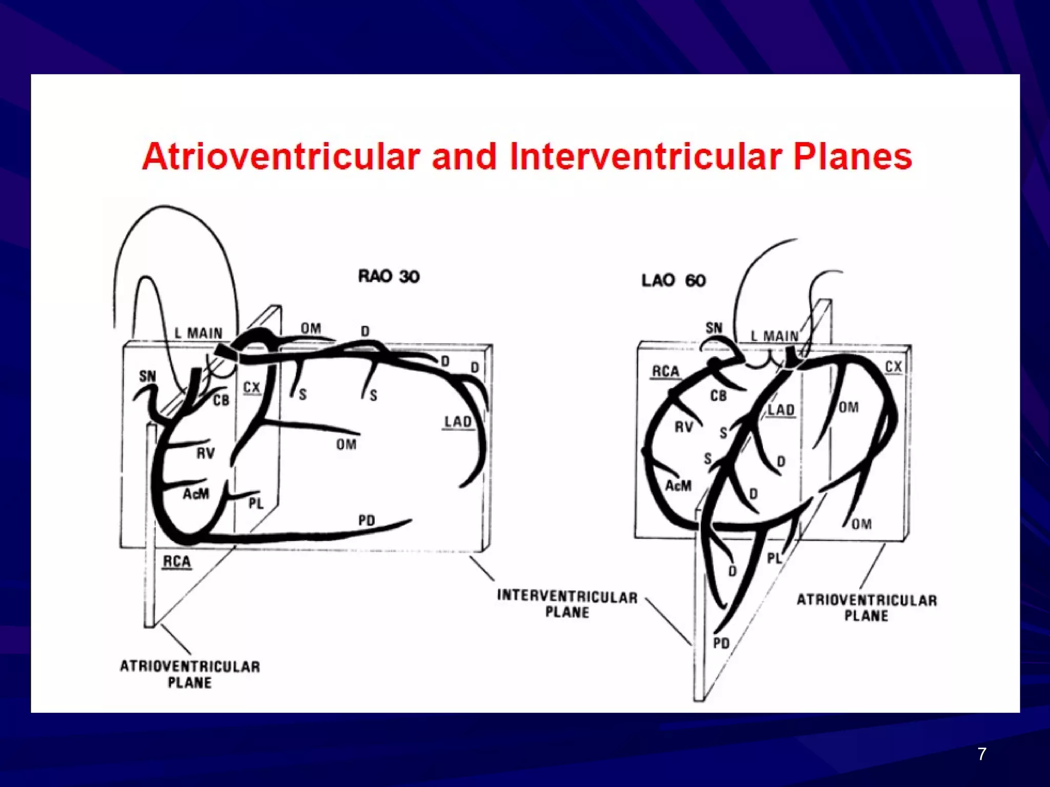Interpretation of coronary angiogram | PPT