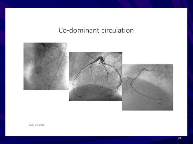 Interpretation of coronary angiogram | PPT