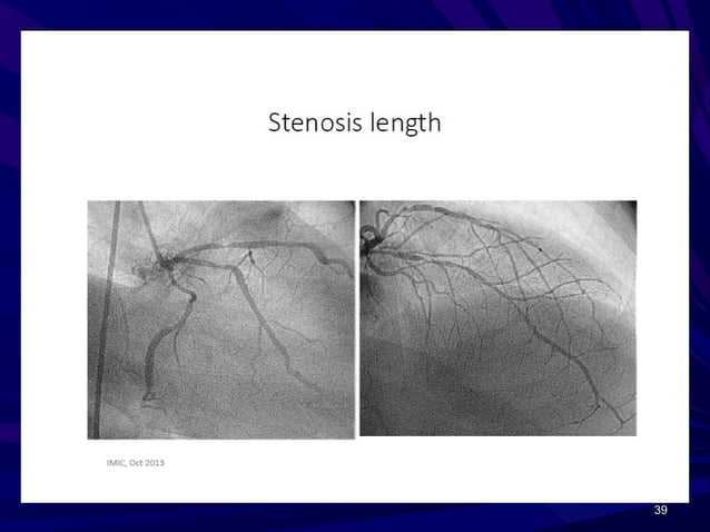 Interpretation of coronary angiogram | PPT