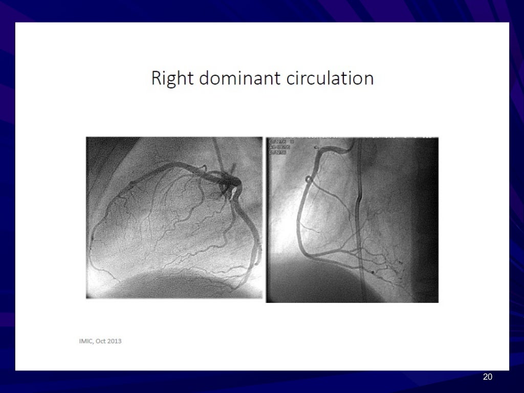 Interpretation of coronary angiogram